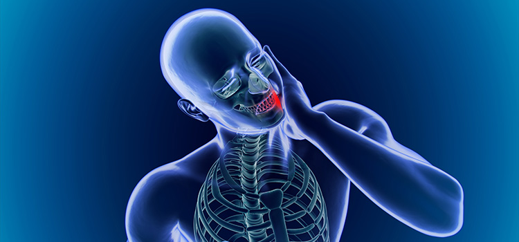 What Are Tooth Abfractions? - Pro Teeth Guard