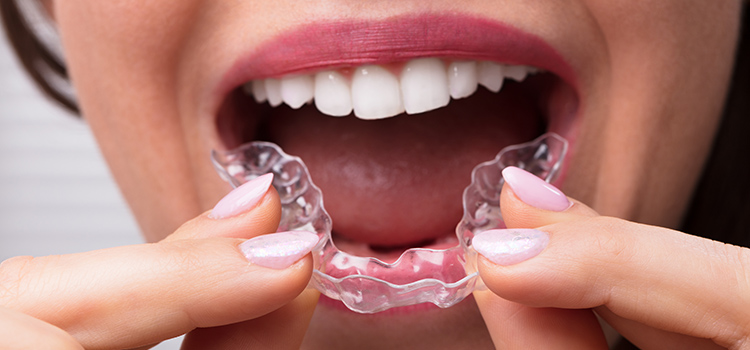 Swollen Gums From Mouth Guard - Pro Teeth Guard