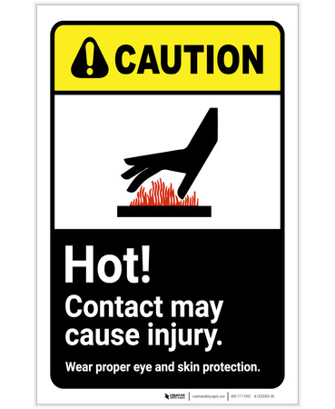 Caution: Hot! Contact May Cause Injury - Wear Proper PPE ANSI Portrait ...