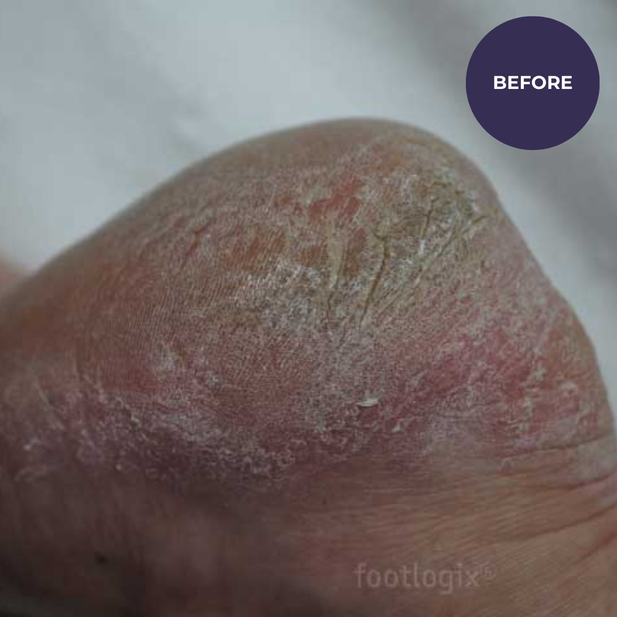 Footlogix DD Cream Mousse Formula 125ml | Sweet Squared