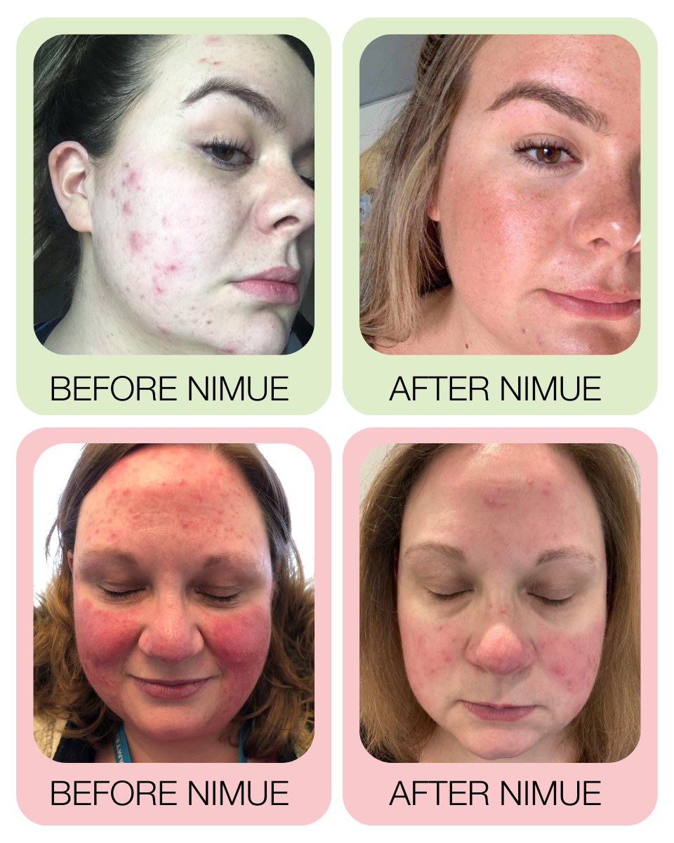 SKINCARE BACKED BY SCIENCE - Real People, Real Results - Sweet Squared