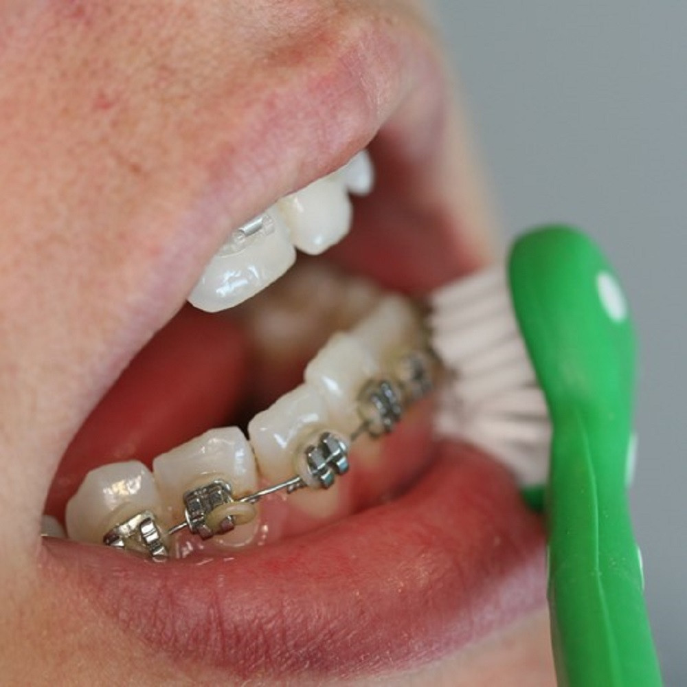 Surround Three-Sided Toothbrush - Adult