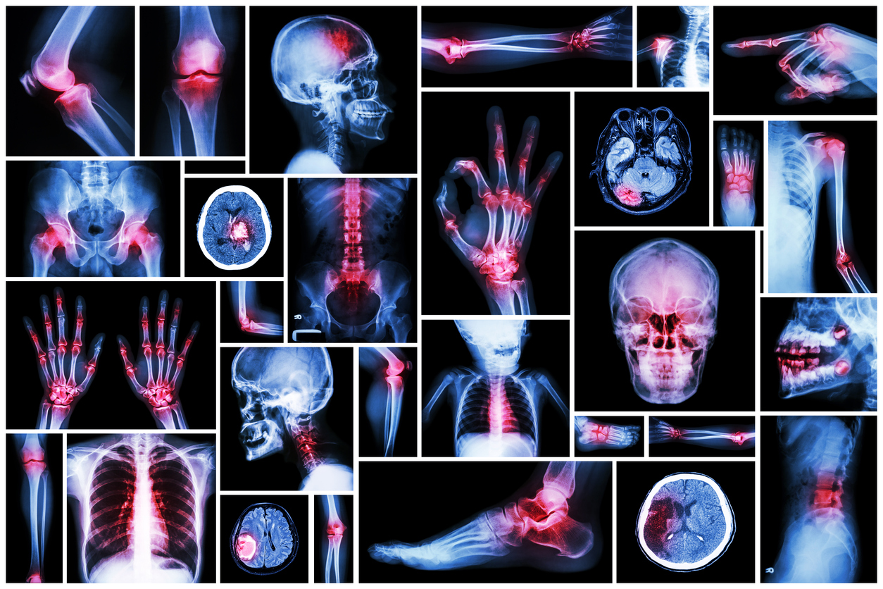 Decoding Inflammation: The Root of Many Modern Illnesses - VitaminDecade