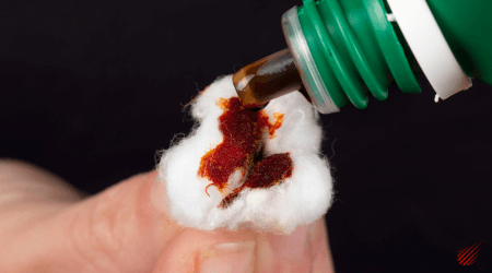 Betadine: The Powerful Antiseptic Solution for Wound Care - xeteor