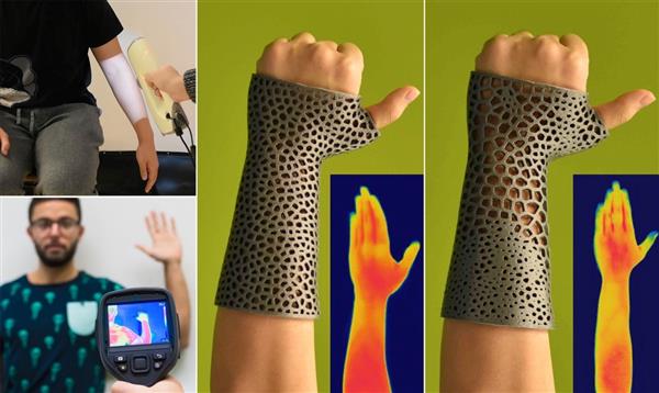 3D printed orthopaedic casts with improved thermal comfort - AUSTiC SHOP