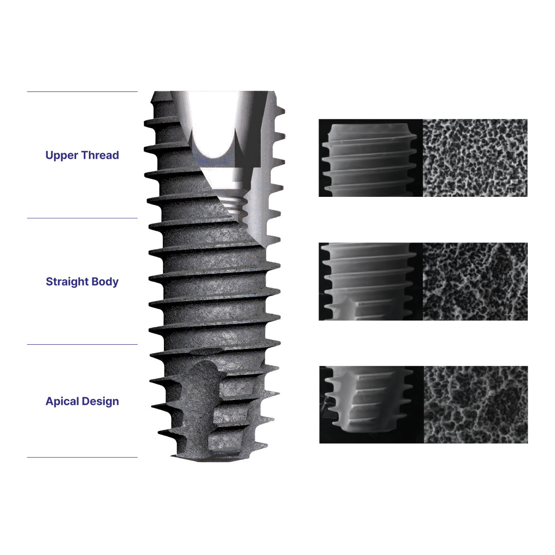 DIO UF(ll) Fixture, Narrow