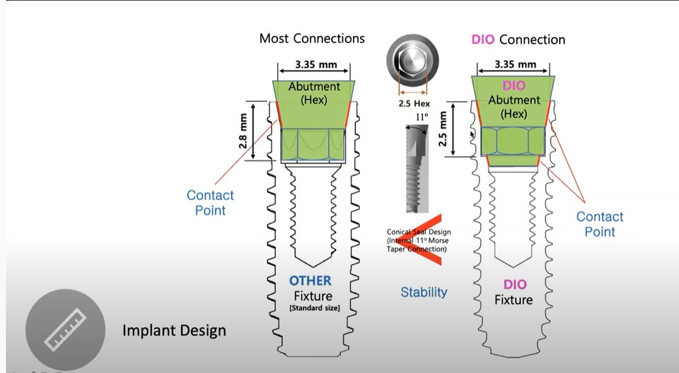 Why Dio - WhiteCap Dental Solutions
