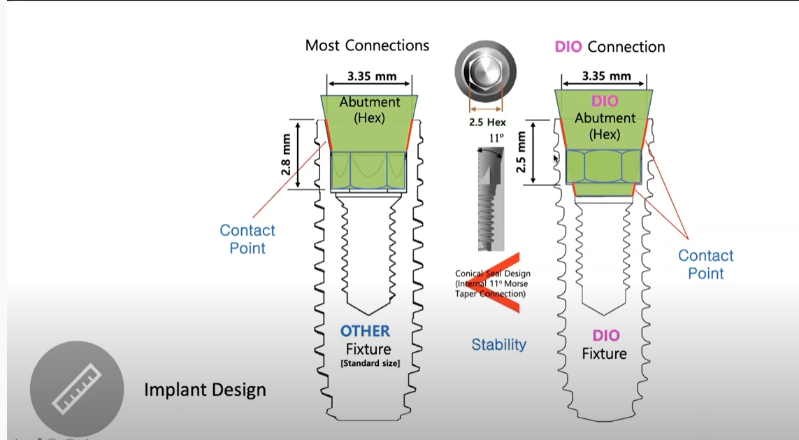 Why Dio - Whitecap Dental Solution