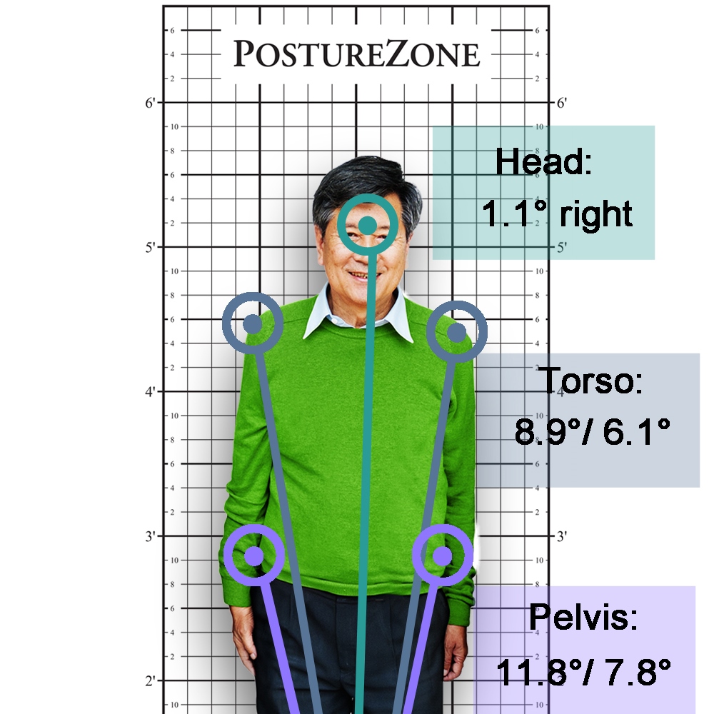 Why You Must Start Taking Posture Pictures - PostureZone