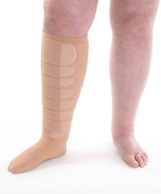 Compression Garments - For Legs - Haddenham LymphStore US