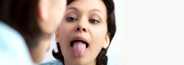 Geographic Tongue: Causes & Treatments - Oral-B