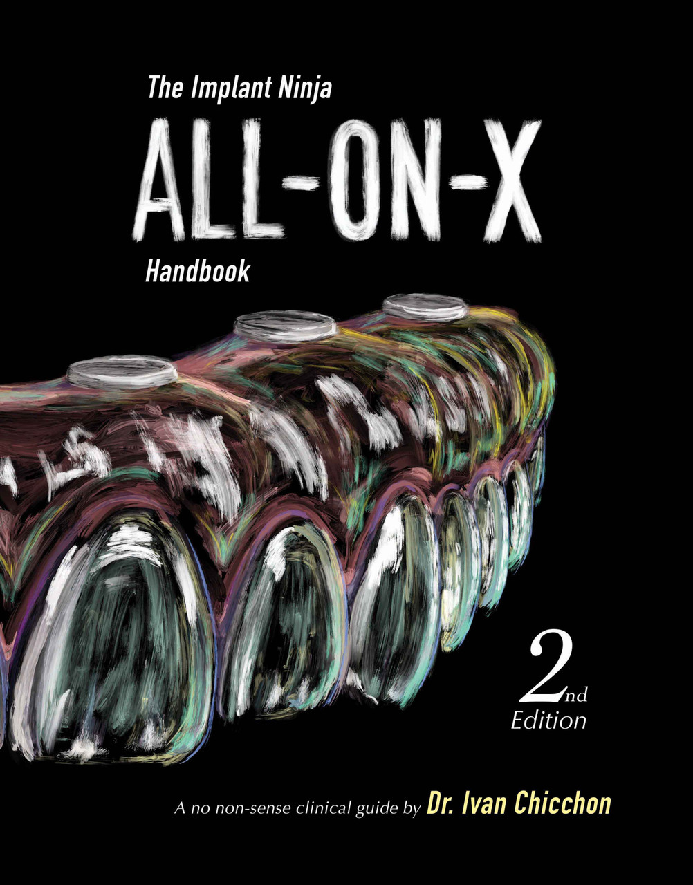 All on X Handbook (eBook) - Implant Ninja