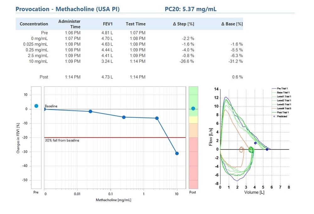 ndd EasyOne Pro LAB PFT machine, MBW, FRC and LCI With DLCO Valve