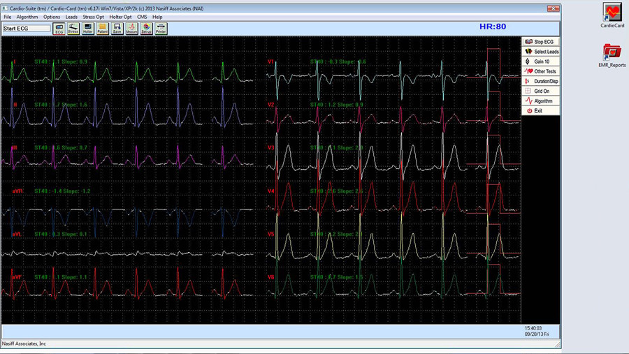 Cardiocard PC Based Resting ECG BT