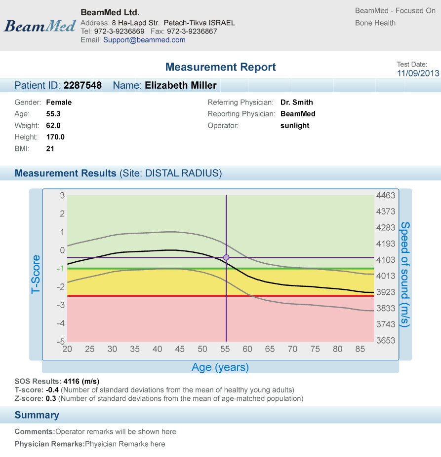 Sunlight MiniOmni Portable bone density scanner