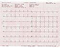 ECG Medi-Graph Paper for Bionet ECG - Shop Henan Medical