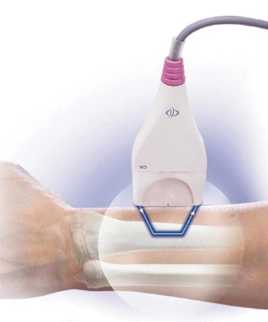 Sunlight MiniOmni Portable bone density scanner