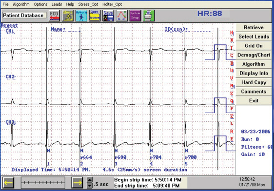 Nasiff CardioCard PC Based Holter ECG System - Shop Henan Medical