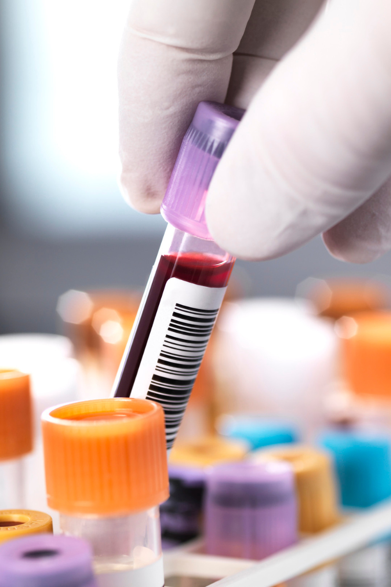 The Art of Staining: How it Enhances Hematology - Cenmed Enterprises