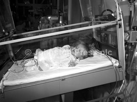 20327289-3-month-old Alice Rutherford made medical history by being the ...