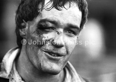 22664717-Edinburgh s Jim Calder keeps smiling after receiving an eye ...