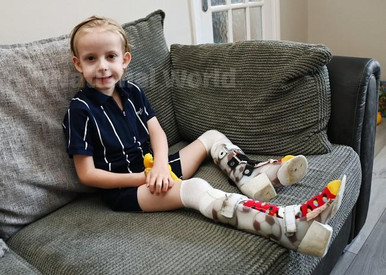 39718571-WIGAN - 23-05-23 Levi Hewitt, five, from Leigh is recovering ...