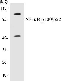 NF-kappaB p100/p52 Colorimetric Cell-Based ELISA Kit (CBCAB00336)
