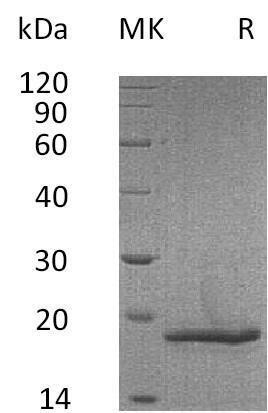 Mouse COL18A1/Endostatin Recombinant Protein (His Tag) (RPES0100)