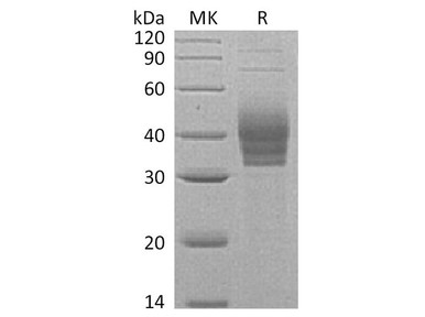 Human Cerberus/CER1 Recombinant Protein (His Tag) (RPES0393)