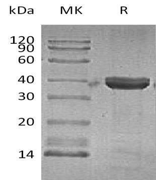 Human Cathepsin Z Recombinant Protein (His Tag) (Active) (RPES1271)