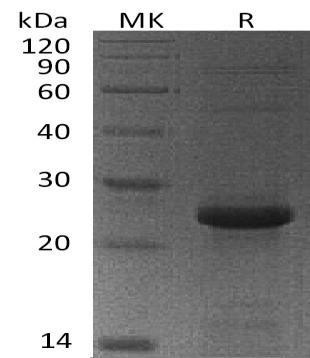 Human MGMT Recombinant Protein (His Tag) (RPES1838)