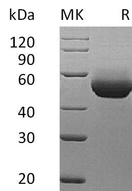 Mouse IL-5RA/IL-5 Ralpha Recombinant Protein (Human Cells, His Tag ...