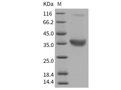 Human ACP5/TRAP Recombinant Protein (His Tag) (RPES2096)
