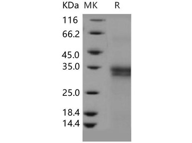 Human IFI30 Recombinant Protein (His Tag) (RPES2221)