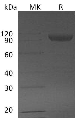 Mouse SerpinF2/SERPINF2 Recombinant Protein (Fc Tag) (RPES2915)