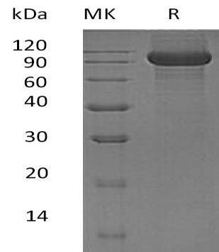 Human KEL/CD238 Recombinant Protein (His Tag) (RPES2930)