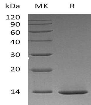Human beta-NGF/NGFB Recombinant Protein (aa 122-241, E. coli) (Active ...