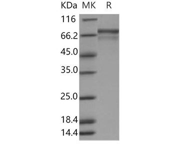 Human PRC1 Recombinant Protein (His Tag) (RPES4084)