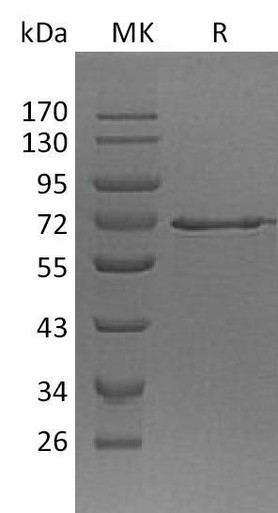 Human METAP2 Recombinant Protein (His Tag) (RPES4554)