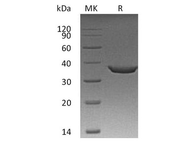 Human STING/TMEM173 Recombinant Protein (Sumo & His Tag) (RPES4727)