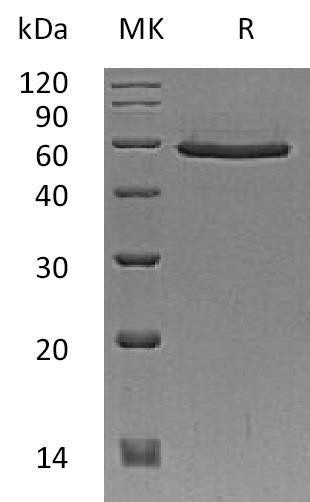 Human SMAD3 Recombinant Protein (His & Flag Tag) (RPES4825)