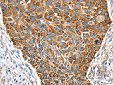 Anti-SNX11 Antibody (PACO17135) | IHC