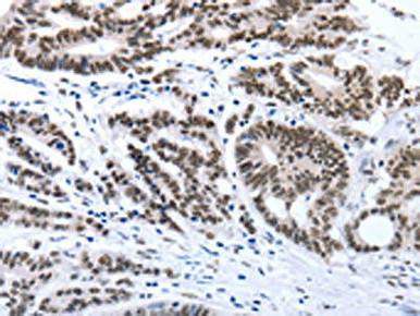 Anti-Map2 Antibody (PACO18441) | IHC