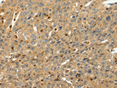 Anti-RRAD Antibody (PACO18859) | IHC