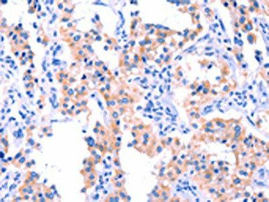 Anti-ERN2 Antibody (PACO19617) | IHC