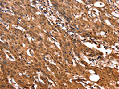 Anti-ERN2 Antibody (PACO19618) | IHC