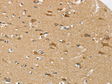 Anti-SEZ6L Antibody (PACO20450) | IHC