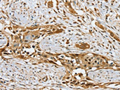 Anti-SEZ6L Antibody (PACO20451) | IHC