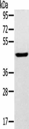 Anti-SLC16A8 Antibody (PACO20474) | WB, IHC