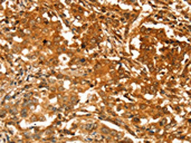 Anti-SLC41A2 Antibody (PACO20509) | IHC
